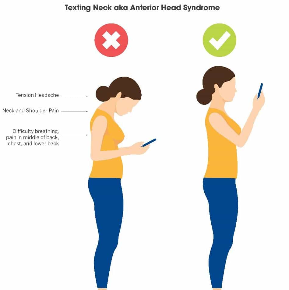 How to Fix Forward Head Posture [Guide]